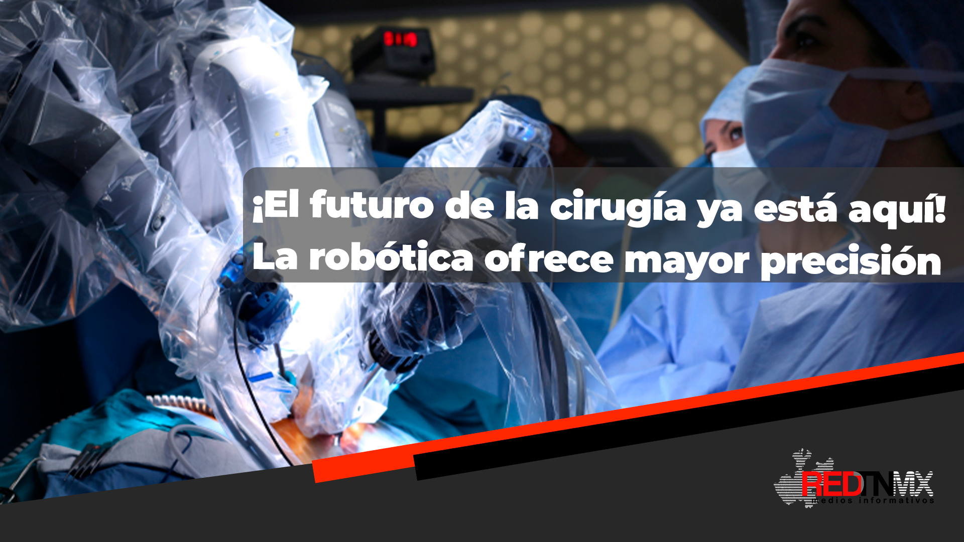 La robótica en la cirugía: Precisión y eficiencia al servicio de la ...